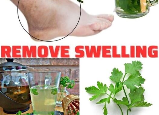 Anti-Inflammatory Swelling-Relief Tea: A Simple Recipe to Reduce ...