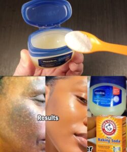 The Magic of Baking Soda and Vaseline: A Quick and Effective Remedy ...