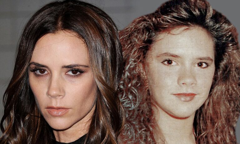 Discover the Truth Behind Victoria Beckham’s Plastic Surgery Rumors ...